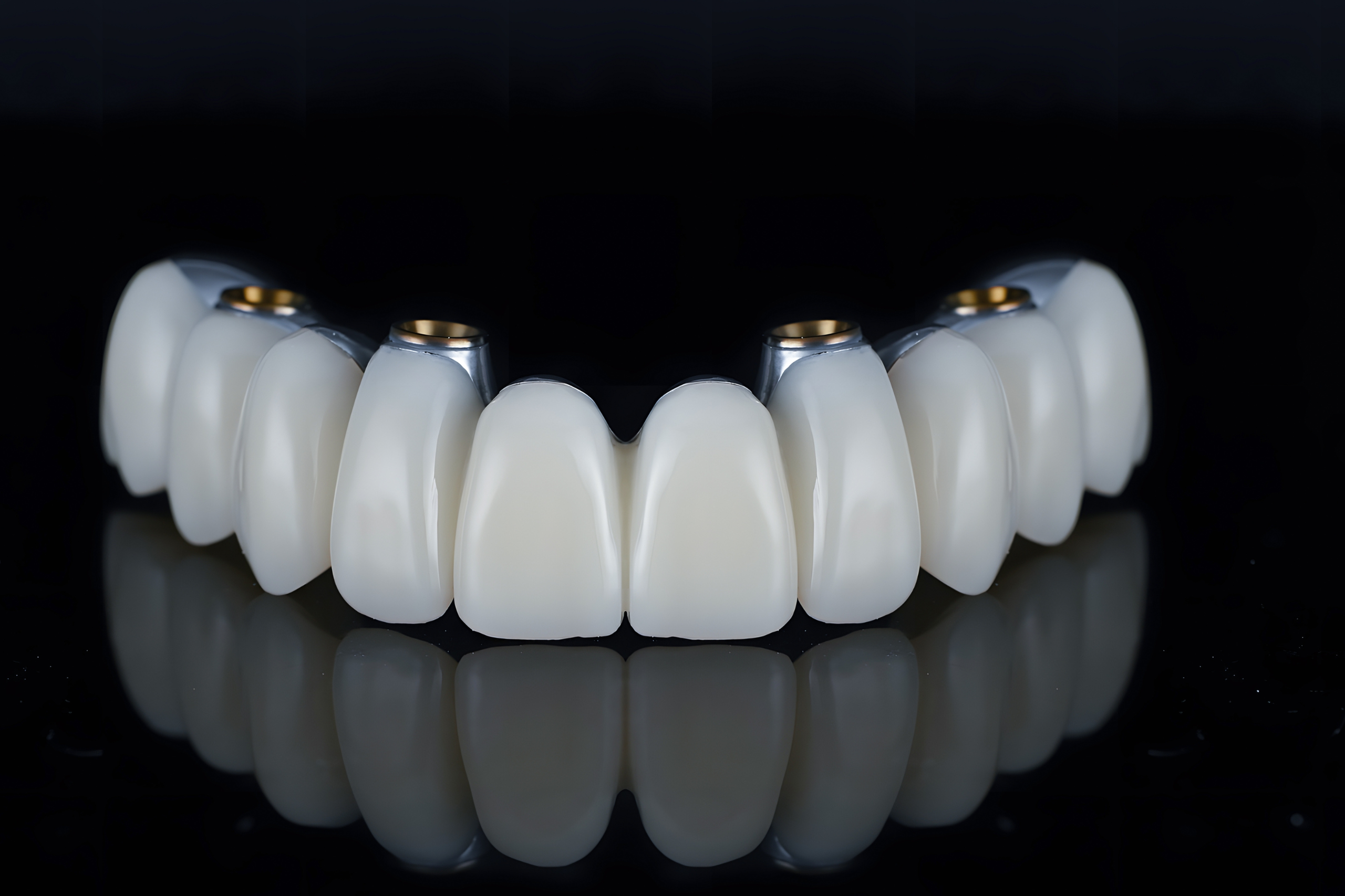 FP1 Prosthesis: Natural Implants | Ten Dental South London